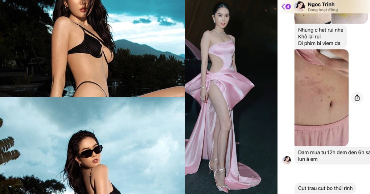 Ngọc Trinh lá ó vì sự cố sức khỏe đáng báo động, nguy cơ bị xóa sổ danh hiệu nữ hoàng n.ội y ...